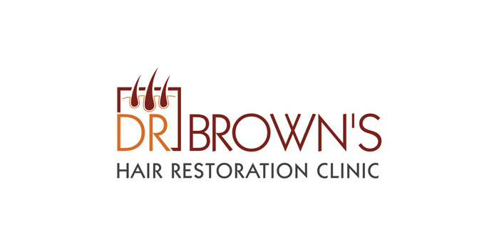 NMAC Offering Turkish Hair Transplants - Bernews